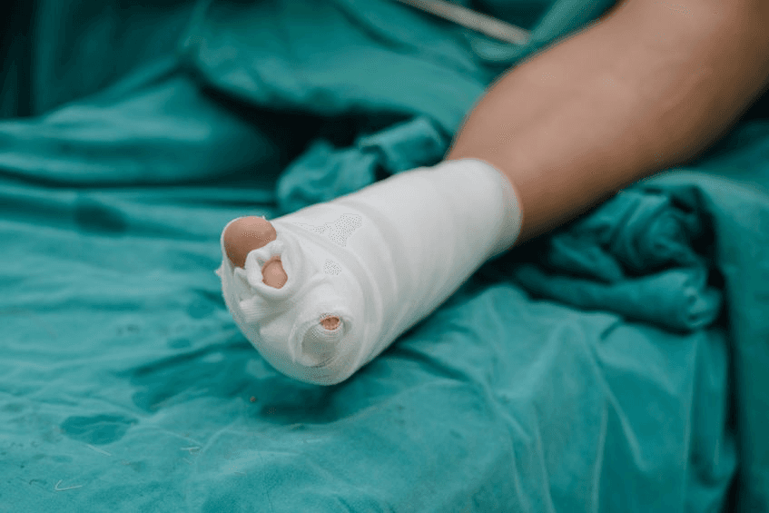 Foot injury at work claims guide